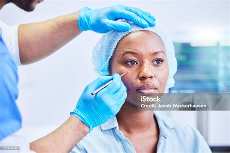 미용 미용 치료사와 함께 피부과가 있는 병원에서 성형 수술 펜 흑인 여성 외과 의사 의사와 함께 클리닉에서 스킨케어 화장품 및 웰빙을 위한 얼굴 변화 및 필러 20 24세에