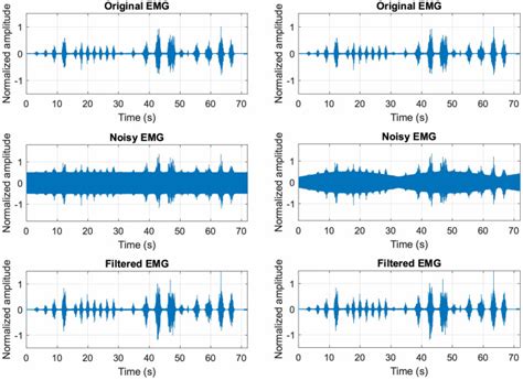 a smart approach to emg envelope extraction and powerful denoising for human machine interfaces