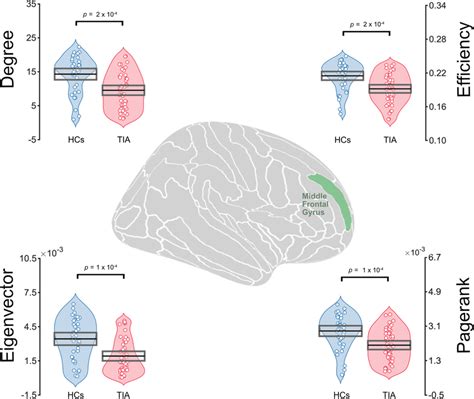 decreased nodal centrality in transient ischemic attack tia compared