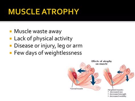 Muscle Atrophy On Astronauts Ppt