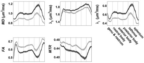 Callosal Mri Abnormalities In Multiple Sclerosis Download Scientific Diagram