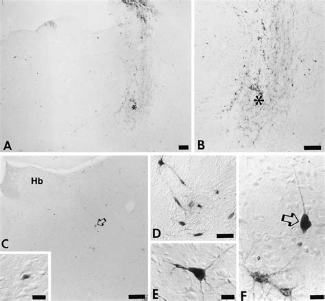 Interconnected Parallel Circuits Between Rat Nucleus Accumbens And Thalamus Revealed By