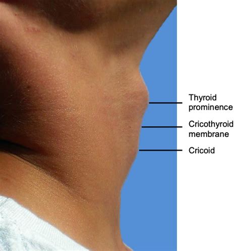 Cricothyroid Membrane Diagram