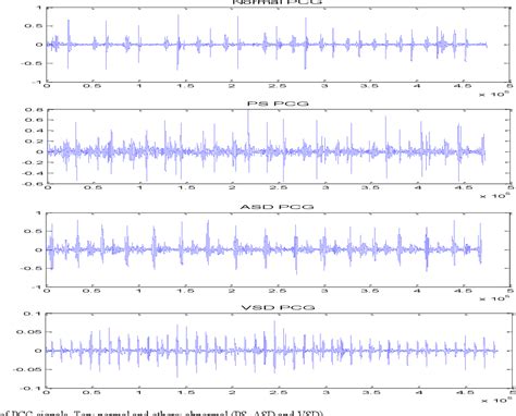 Figure 1 From Phonocardiography Signal Classification By Applying Feature Space Transformations