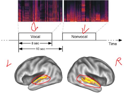 Voice Processing Flashcards Quizlet