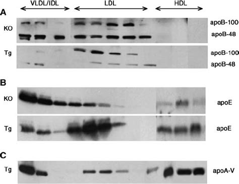 Subfractions Of Plasma Lipoproteins Isolated By Cumulative Rate Download Scientific Diagram