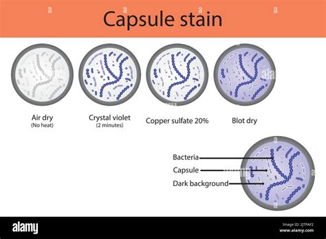 Capsule Staining Microbiology Lab Technique Steps Diagram Using Crystal Violet And Copper