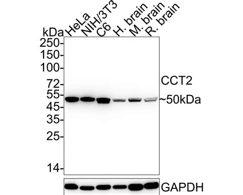 Cct2 Recombinant Rabbit Monoclonal Antibody [je37 96] Ha722240 Huabio