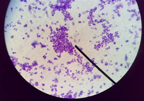 Bentuk Bakteri Staphylococcus Aureus Id