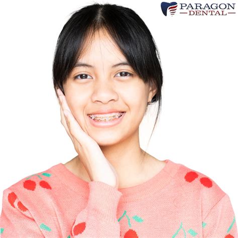 Cosmetic Dentistry A Guide To Enhancing Your Smile Theomnibuzz