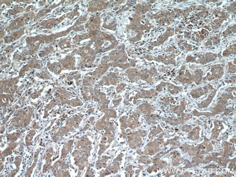 Slc25a12 Antibody 26804 1 Ap Proteintech