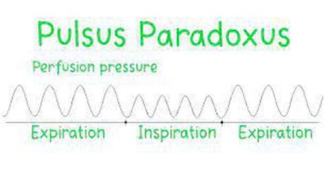 Pulsus Paradoxus Medizzy