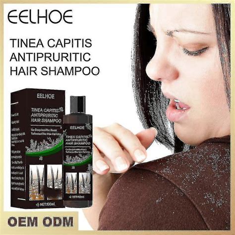 Scalp Ringworm Anti Itch Shampoo Dandruff Control Oil Anti Itch Shampoo Anti Loss Oil Control
