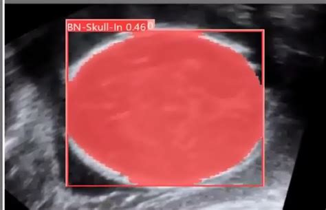 Why Is The Boundary Recognition Of Segments Own Dataset And Training