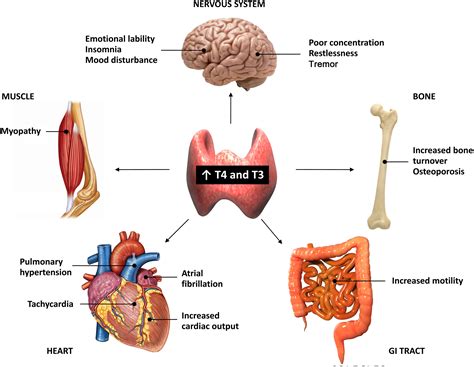 Hyperdynamic Right Heart Function In Graves Hyperthyroidism Measured