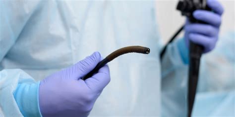 Endoscopy Test Preparation A Complete Guide