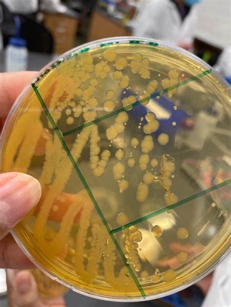 Both Agar Plates Contain Two Different Bacteria