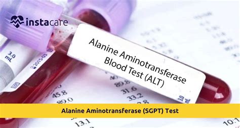 Sgpt Alanine Aminotransferase Test Alt Levels Causes And Liver Health