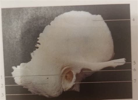 Lateral Temporal Bone Diagram Quizlet
