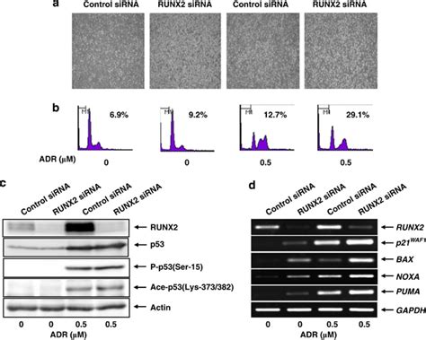 Knockdown Of Runx2 Enhances Adr Mediated Apoptosis U2os Cells Were