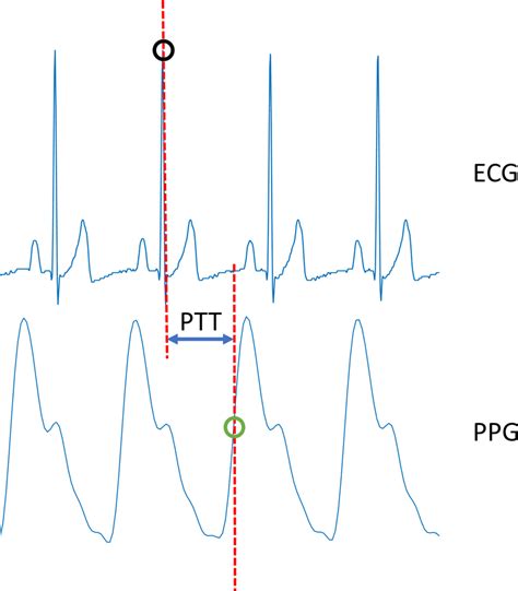 Illustration Of Pulse Transit Time Calculation Pulse Transit Time Is Download Scientific