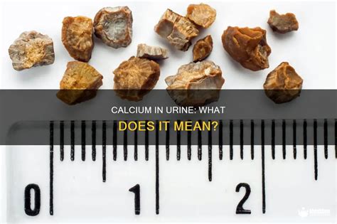 Calcium In Urine What Does It Mean Medshun