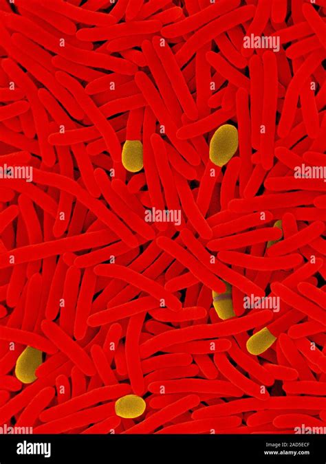 Coloured Scanning Electron Micrograph Sem Of Clostridium Phytofermentans Gram Positive