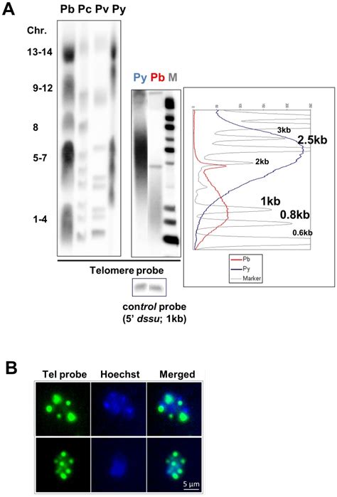 A Determination Of Telomere Length By Telomere Restriction Fragment