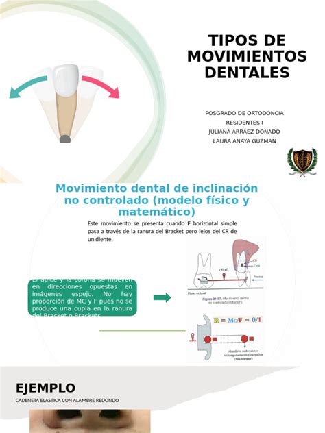 Tipos De Movimientos Dentales En Ortodoncia Pdf Fricción Fuerza