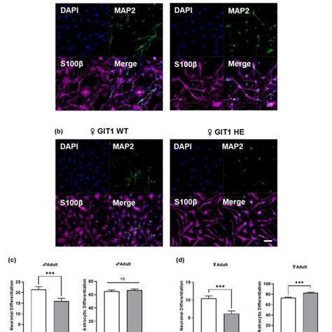 Differentiation Of Subventricular Zone Neural Stem Cells In Adult Git1 Download Scientific