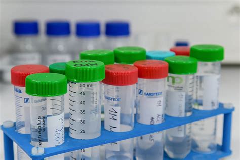 Protein Crystallization Facility Structural Biology Core Facility