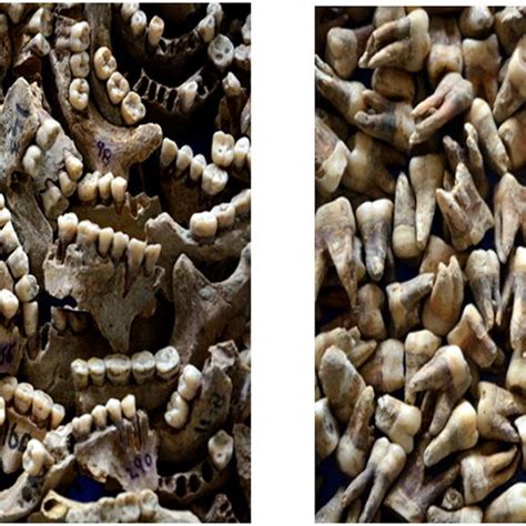 Jaw Fragments And Molar Teeth Segregated From Ajnala Skeletal