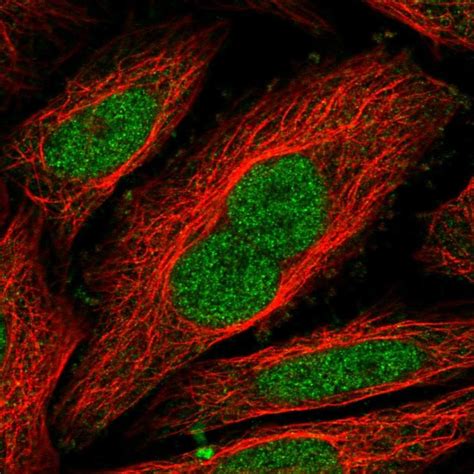 Rabbit Polyclonal Anti Nipbl Antibody Buy For Research Highly Specific Rigorously Validated