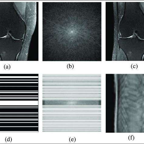 Fast Mri Knee Image Reconstruction From Fully Sampled To Aliased Download Scientific Diagram