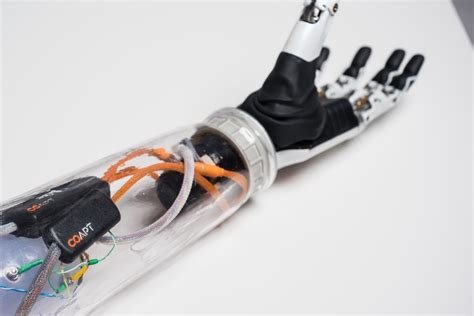 bionics technology