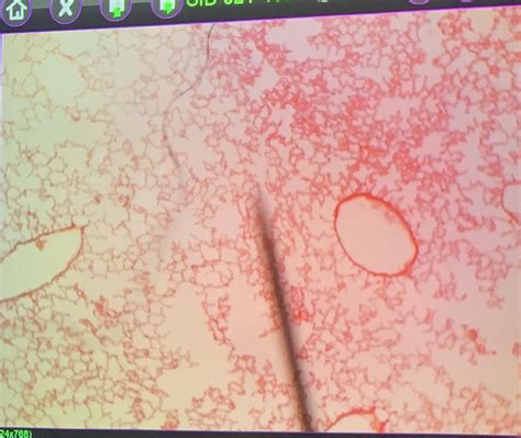 Normal Lung Diagram Quizlet