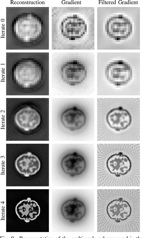 Figure 1 From Multi Scale Learned Iterative Reconstruction Semantic Scholar