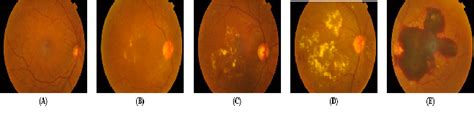 Figure 3 From Hybrid Cnn Svd Based Prominent Feature Extraction And Selection For Grading