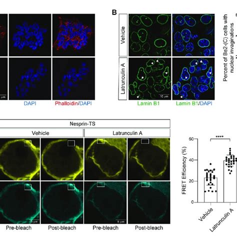 Latrunculin A Induced Depletion Of F Actin Reduces Nuclear Tension In