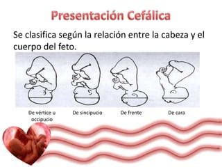 Mecanismos Del Trabajo De Parto Pptx