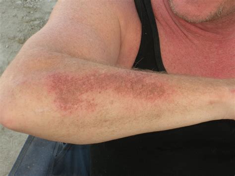 Rebblaster Blog