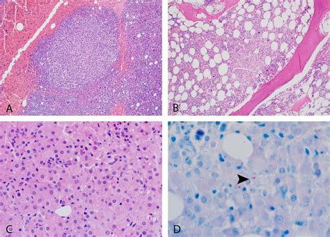 Bone Marrow Histology