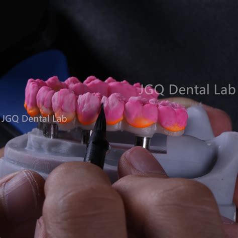 Dental Implant Customize Super Structure All On 6 Full Contour Zirconia