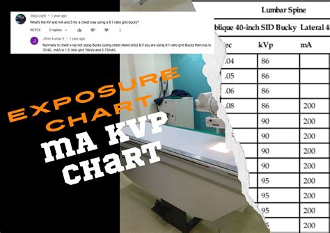 X Ray Exposure Technique Chart Vrogue Co
