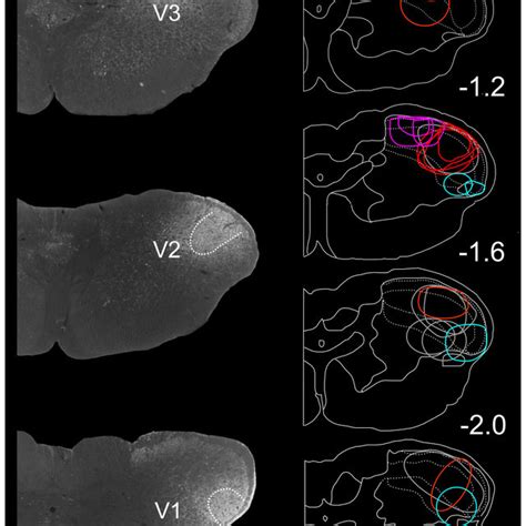 Pdf Bilateral Descending Hypothalamic Projections To The Spinal Trigeminal Nucleus Caudalis In