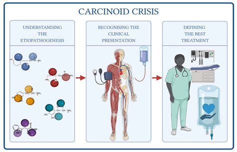 Carcinoid Cancer Symptoms