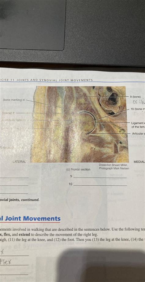 Solved Cise 11 ﻿joints And Synovial Joint Movementsovial
