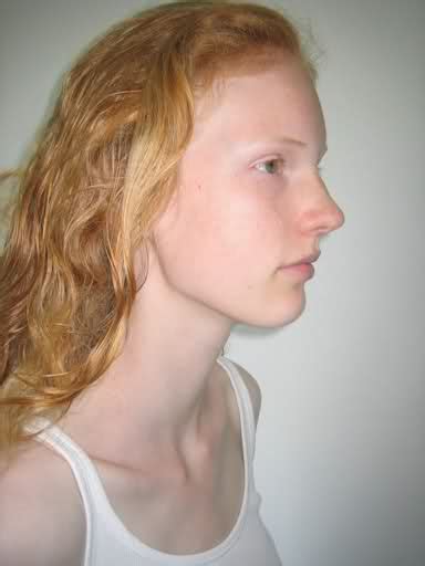 Strawberry Blonde Highlights In Dirty Blonde Hair MEMET NGEPET