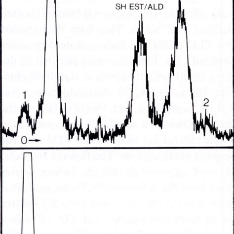 Radio Tlc Traces Of Fractions Eluted From A Sep Pak Cartridge Of 14