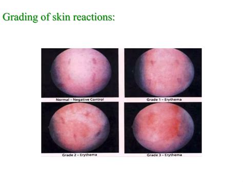Screening Methods For Skin Sensitization Skin Irritation And Dermal